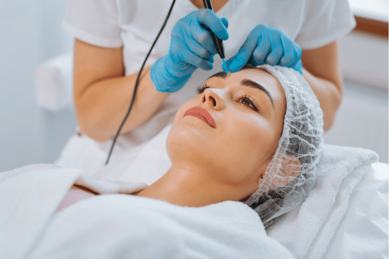 Mole & Skin Tag Removal | Tuscan Sun Spa and Salon